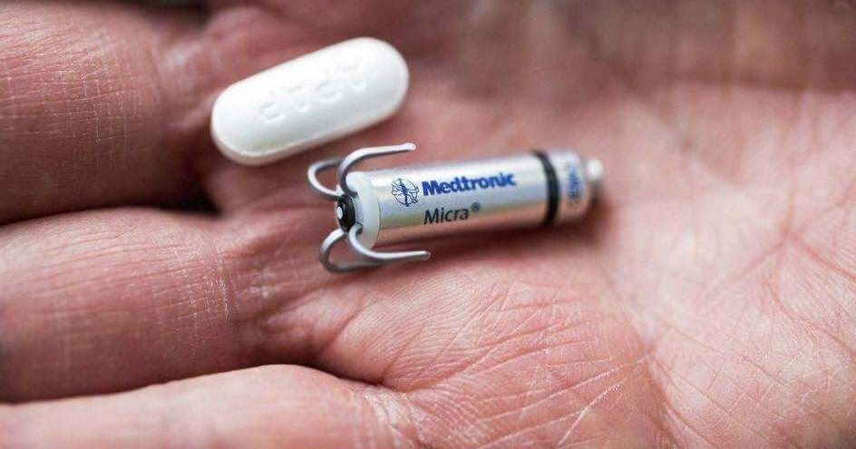 Discapaaccesible: 1º Implante del marcapaso Micra en una adolecente