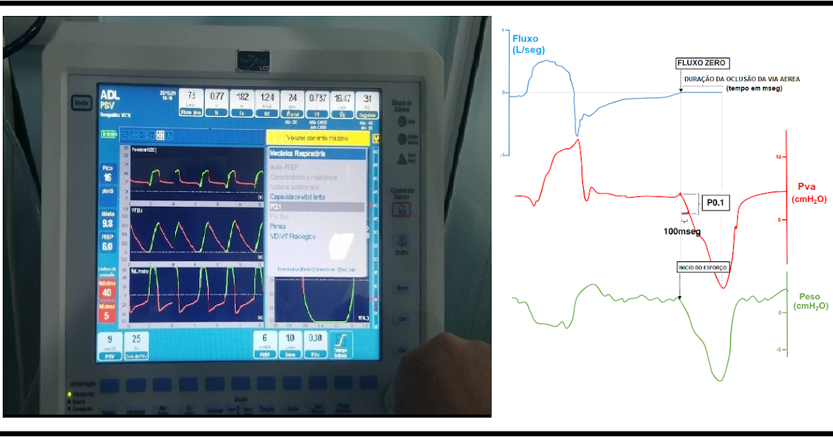 MEDICINA INTENSIVA CUSTOMIZADA