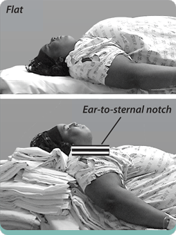 EM Didactic: Airway Pearls from The CRASH Airway Course - Part 1