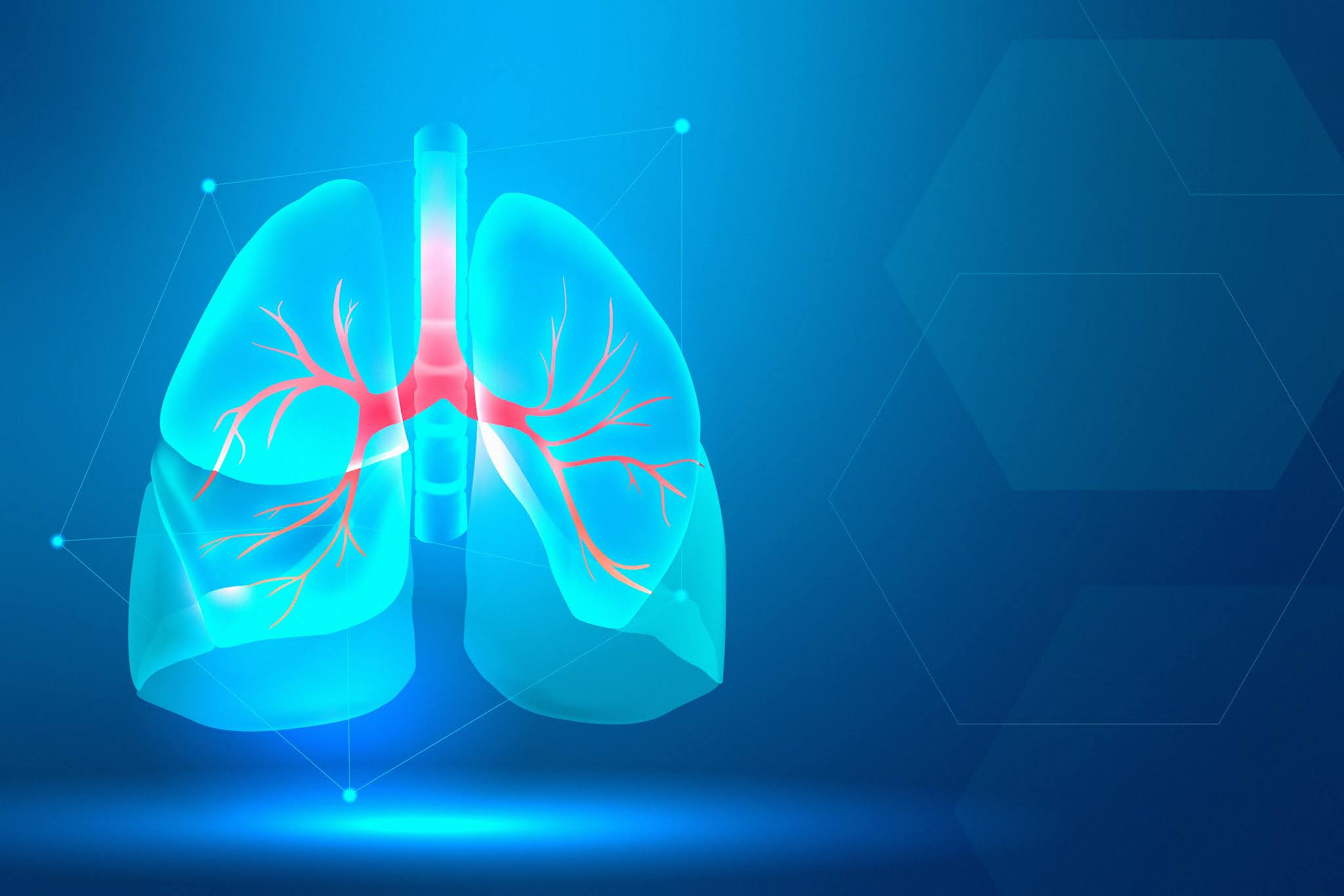 Trasplante De Pulmón Salud En Línea