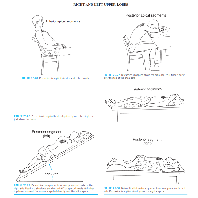 Postural Drainage Positions Pdf