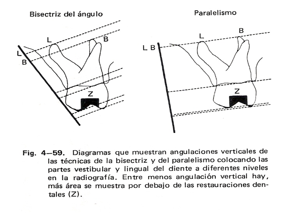 12 a 13 Rx Otoño 2013: 2° Parcial Técnica Bisectriz