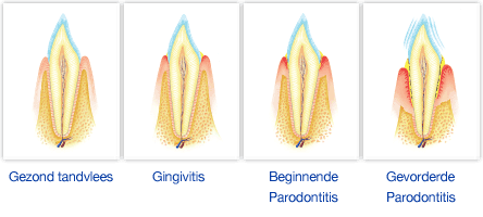 Blogs van Tandartspraktijk Top Dental: juni 2016
