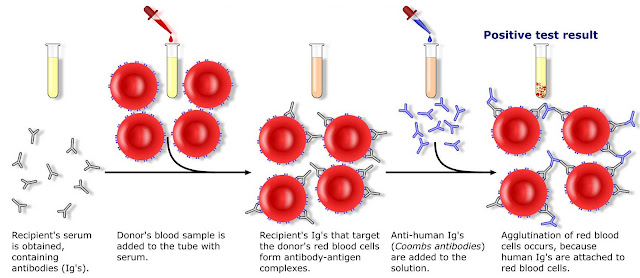 Medical Terms & Сlinical Сases : Coombs test