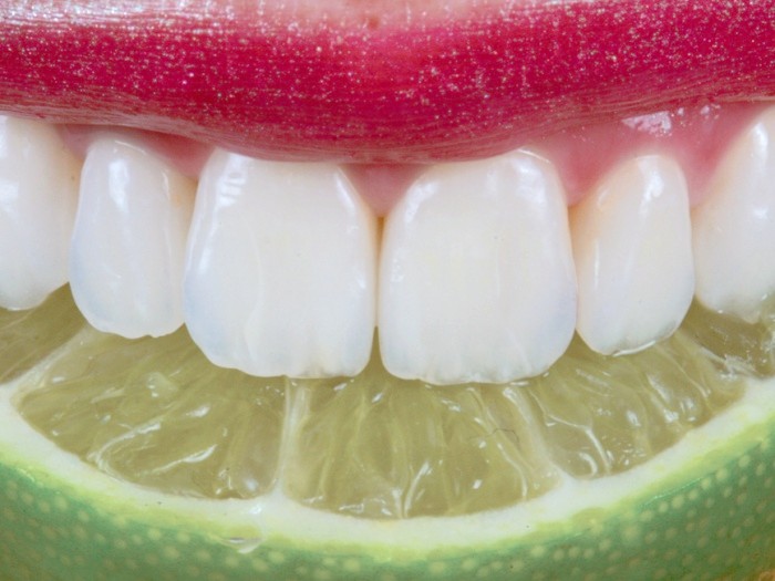 Erosão Ácida - Uma Preocupação Crescente ~ Dentaris Odontologia