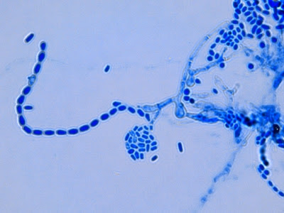 Fun With Microbiology (What's Buggin' You?): Arthrographis species