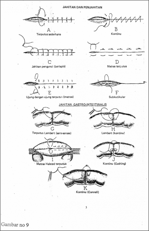 YUME ALMO: Menjahit Luka