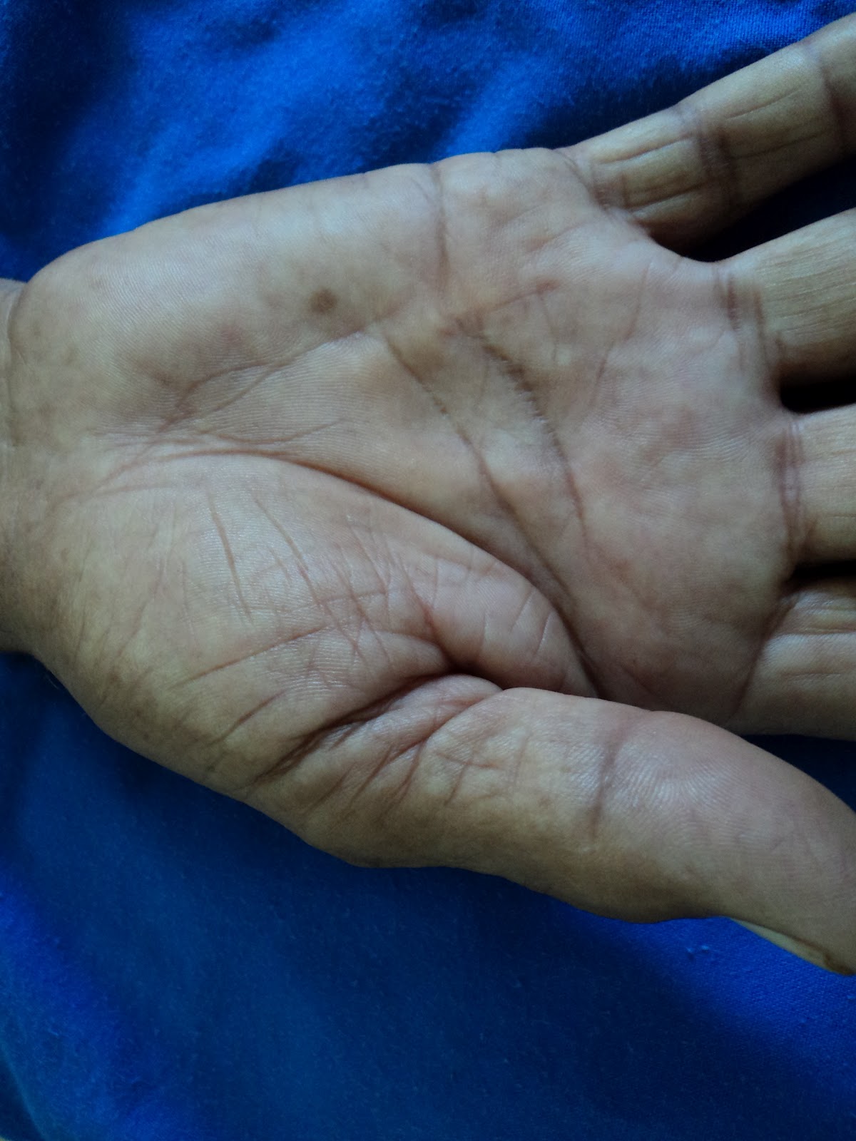 OSSA CARPALIA ©: 2012