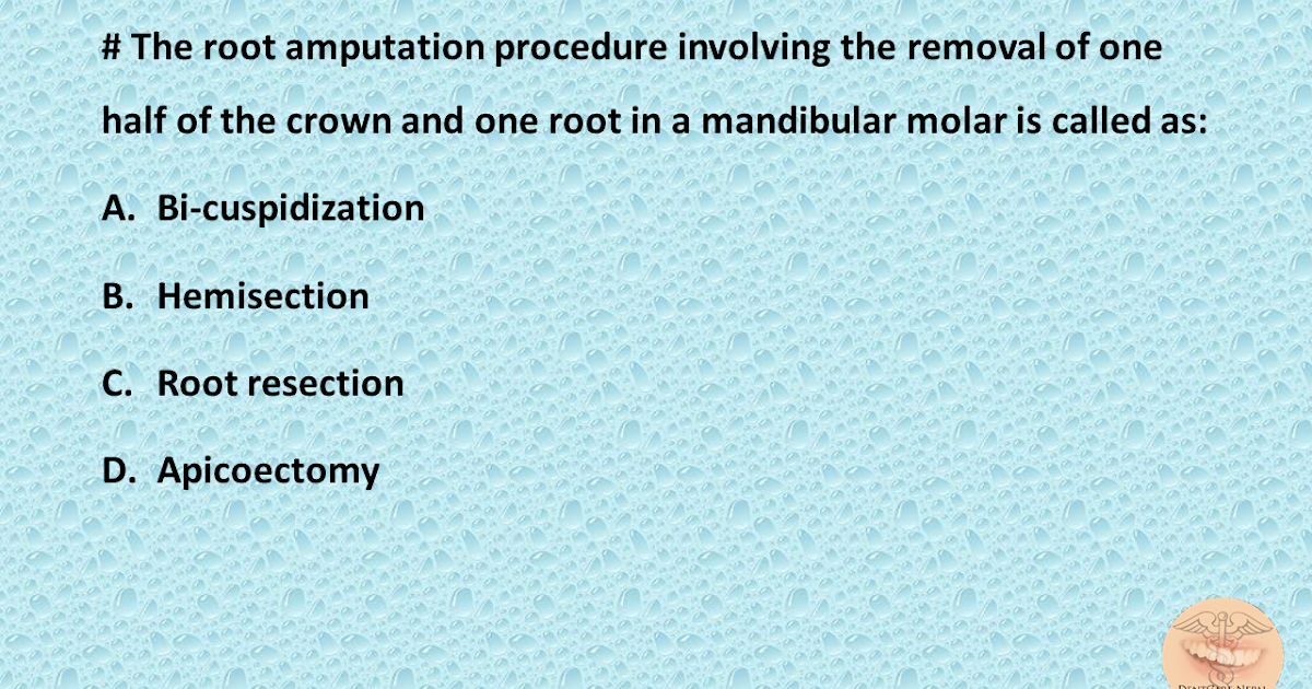 Dentosphere : World of Dentistry: The root amputation procedure involving the removal of one ...