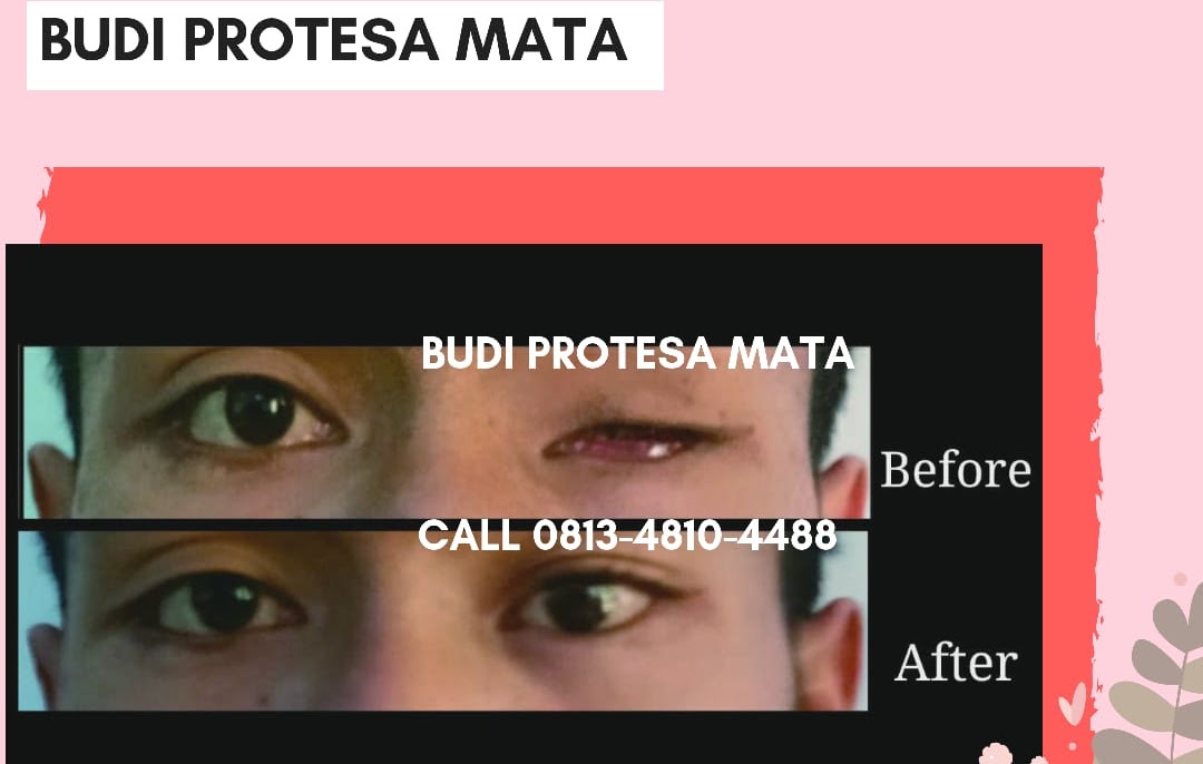 Budi Protesa Mata 3