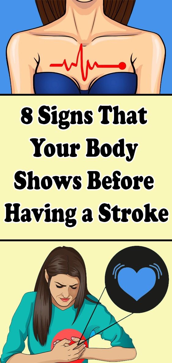 8 Signs That Your Body Shows Before Having a Stroke - medicine health life
