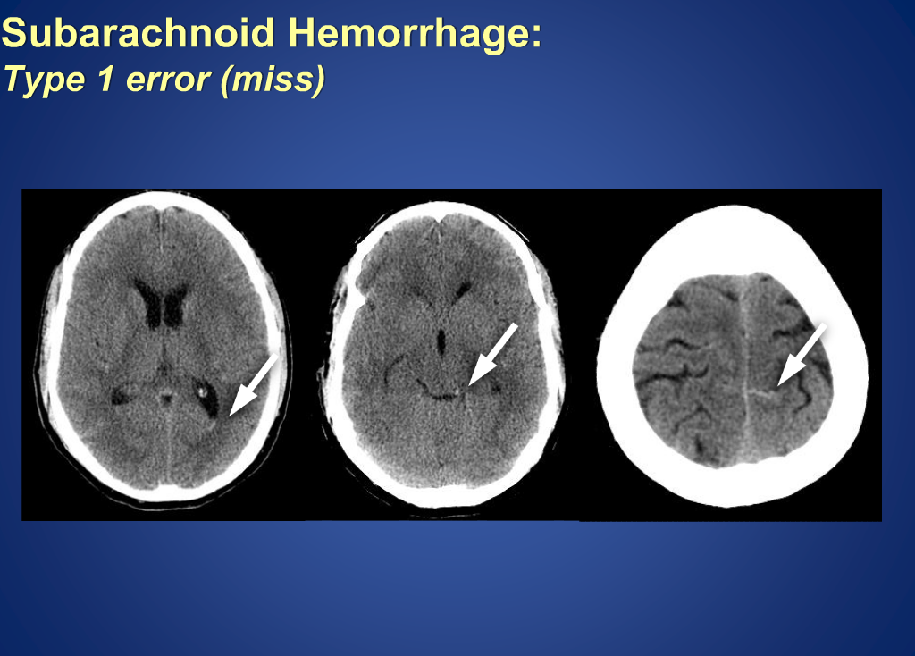 rsna: emergency neuroradiology: 한번더