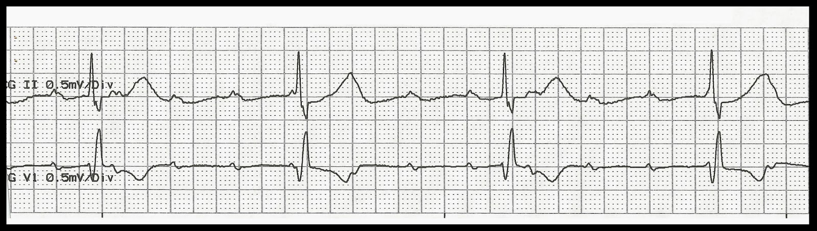 EKG Rhythm Strip Quiz 189