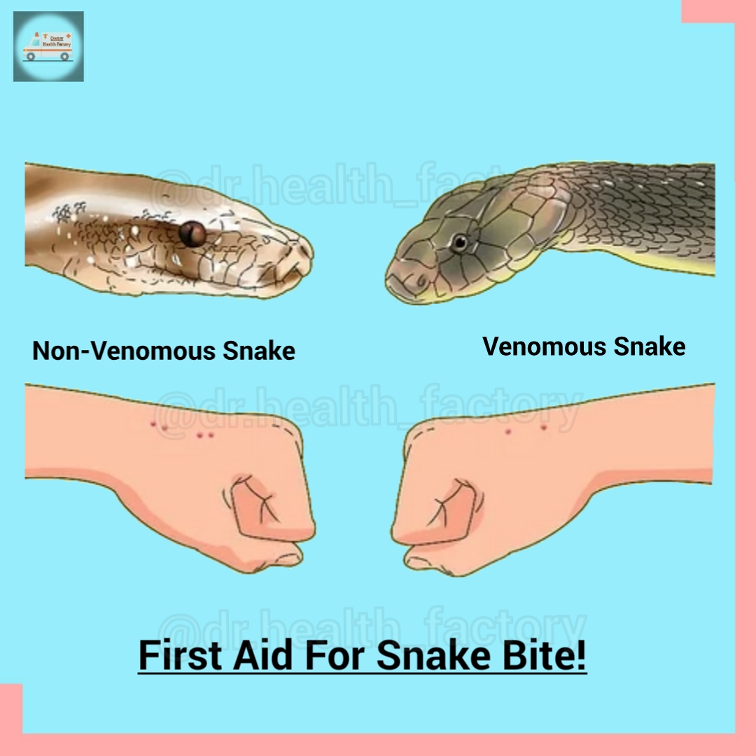 First Aid For Different Situations