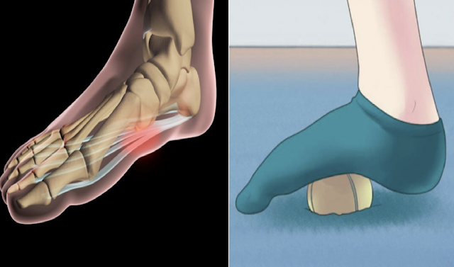 10 Technique On How to Fix Health Problems Brought About By Having Flat ...