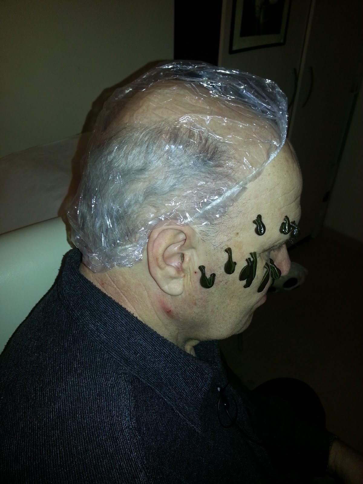 Лечение с пиявици в България