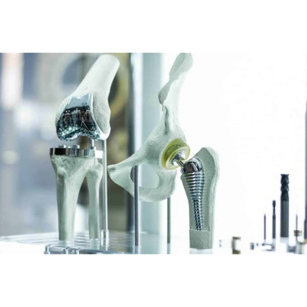 New Tech latest technology : Latest technological orthopedic surgery ...