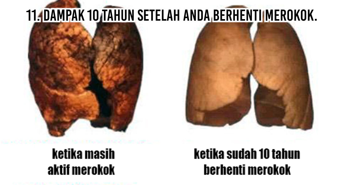 Ini Yang Terjadi Pada Tubuh Saat Kamu Berhenti Merokok | zeropromosi ...