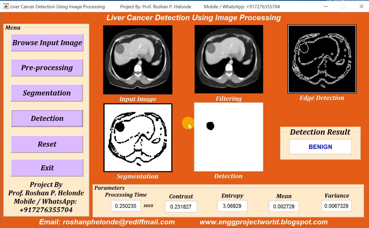 Liver Cancer Detection Using Image Processing Matlab Project With Source Code Ieee Based