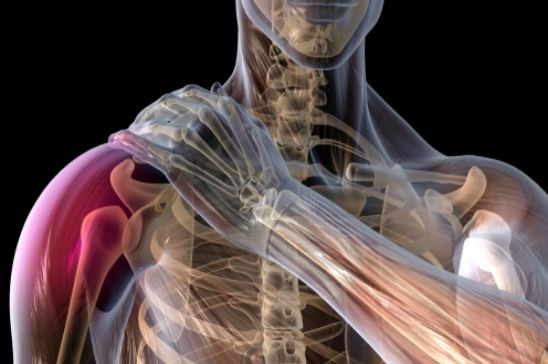 Terapia Física y Rehabilitación en Culiacan : Capsulitis Adhesiva