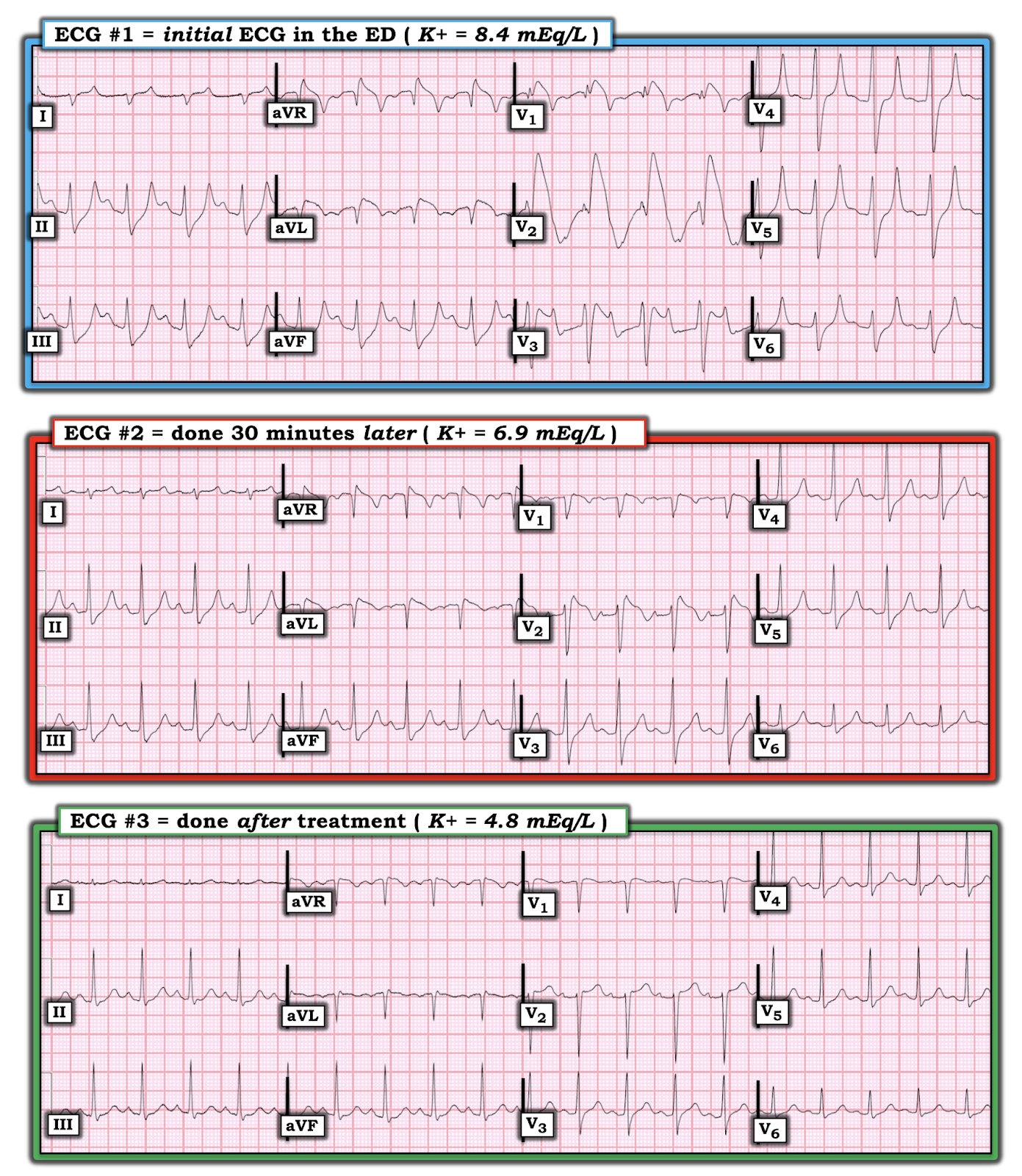 Dr. Smith's ECG Blog