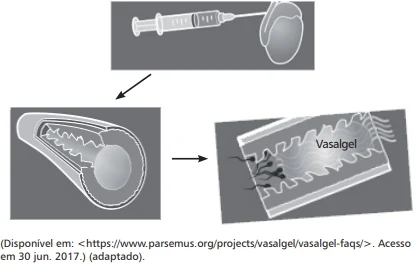 O Vasalgel é um gel polimérico utilizado como contraceptivo em fase de ...