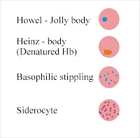 Howell jolly bodies vs Heinz body - Health Care Tips and Natural Remedies