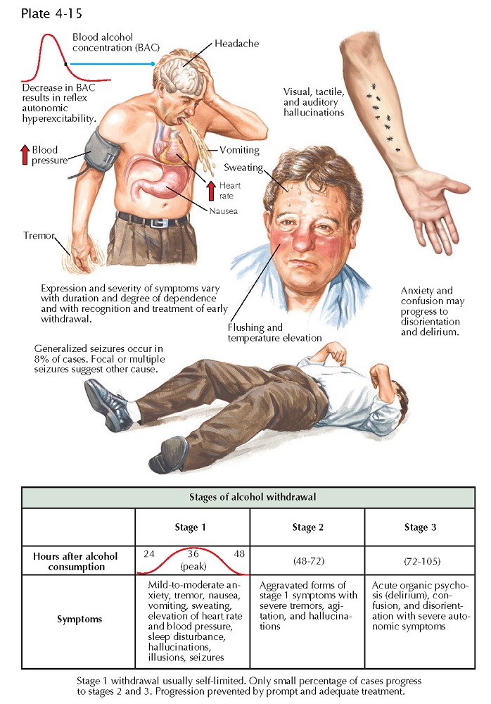 Alcohol Withdrawal - pediagenosis