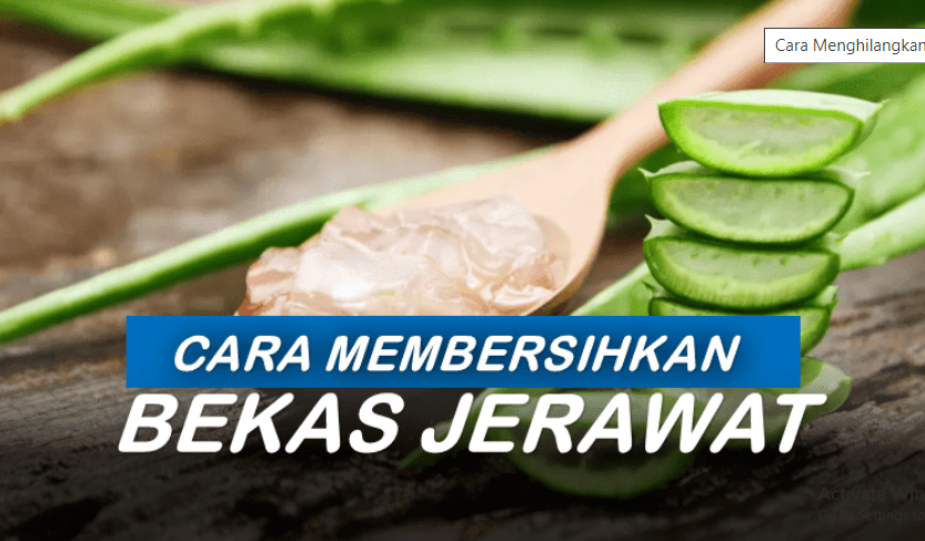 Cara Menghilangkan Noda Hitam Bekas Jerawat Secara Alami - pendapat.id