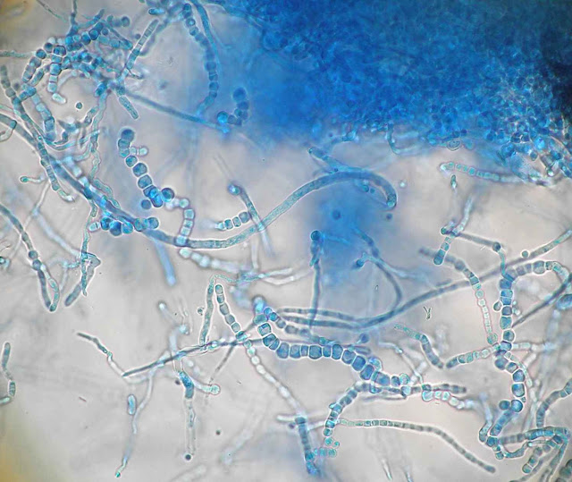 ATLAS MICOLOGIA: TRICHOPHYTON INTERDIGITALE