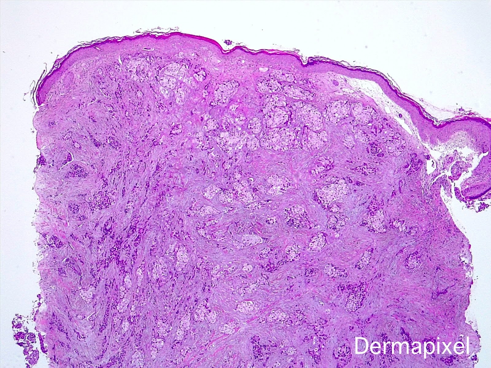 Dermapixel: febrero 2021