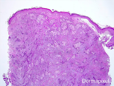 Dermapixel: febrero 2021