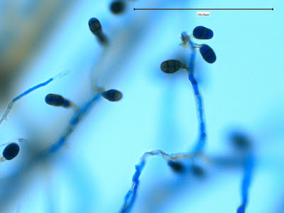 Fun With Microbiology (What's Buggin' You?): Pithomyces species