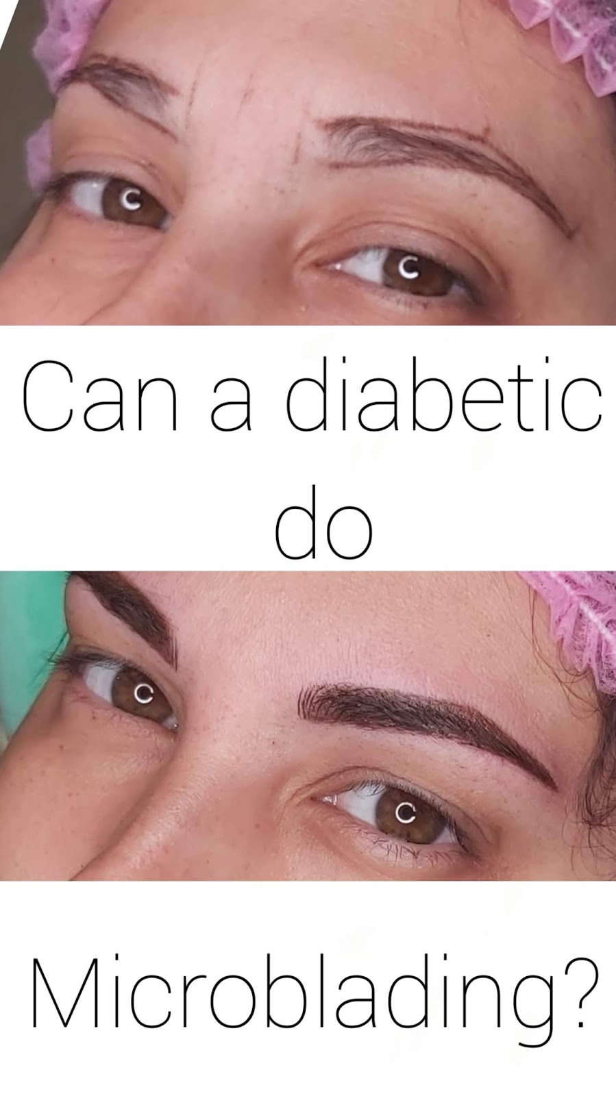 Elogios a mis Locuras: Can a diabetic do Microblading? / ¿Puede una ...
