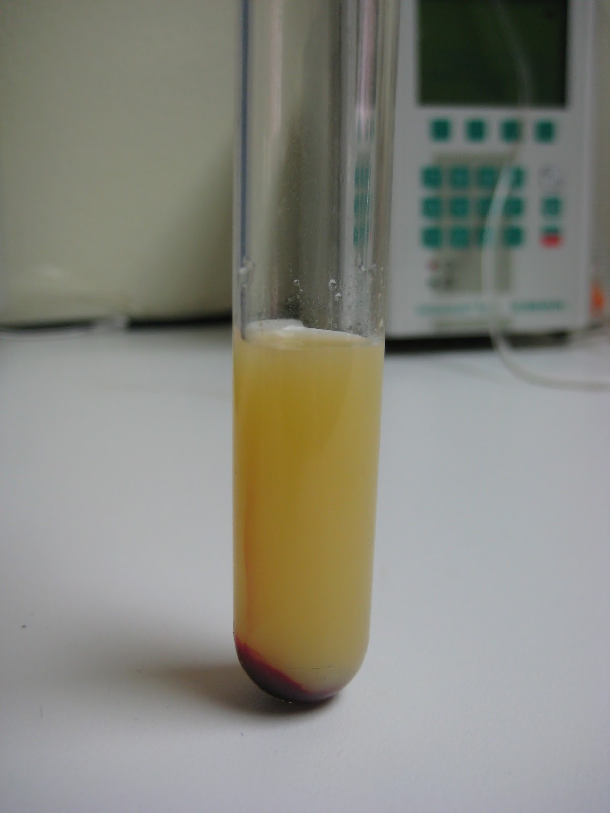 Analisis Clinicos: 4. Fluidos Corporales