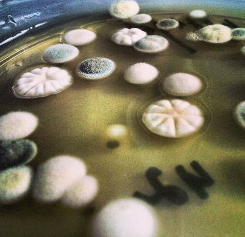Medical Laboratory and Biomedical Science: Fungal Colonies