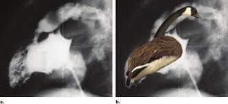 Chest Medicine Made Easy-Dr Deepu: Classical X Ray Signs in congenital ...