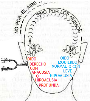 Acumetría Fónica e Instrumental: Test de Rinne y Test de Weber ...