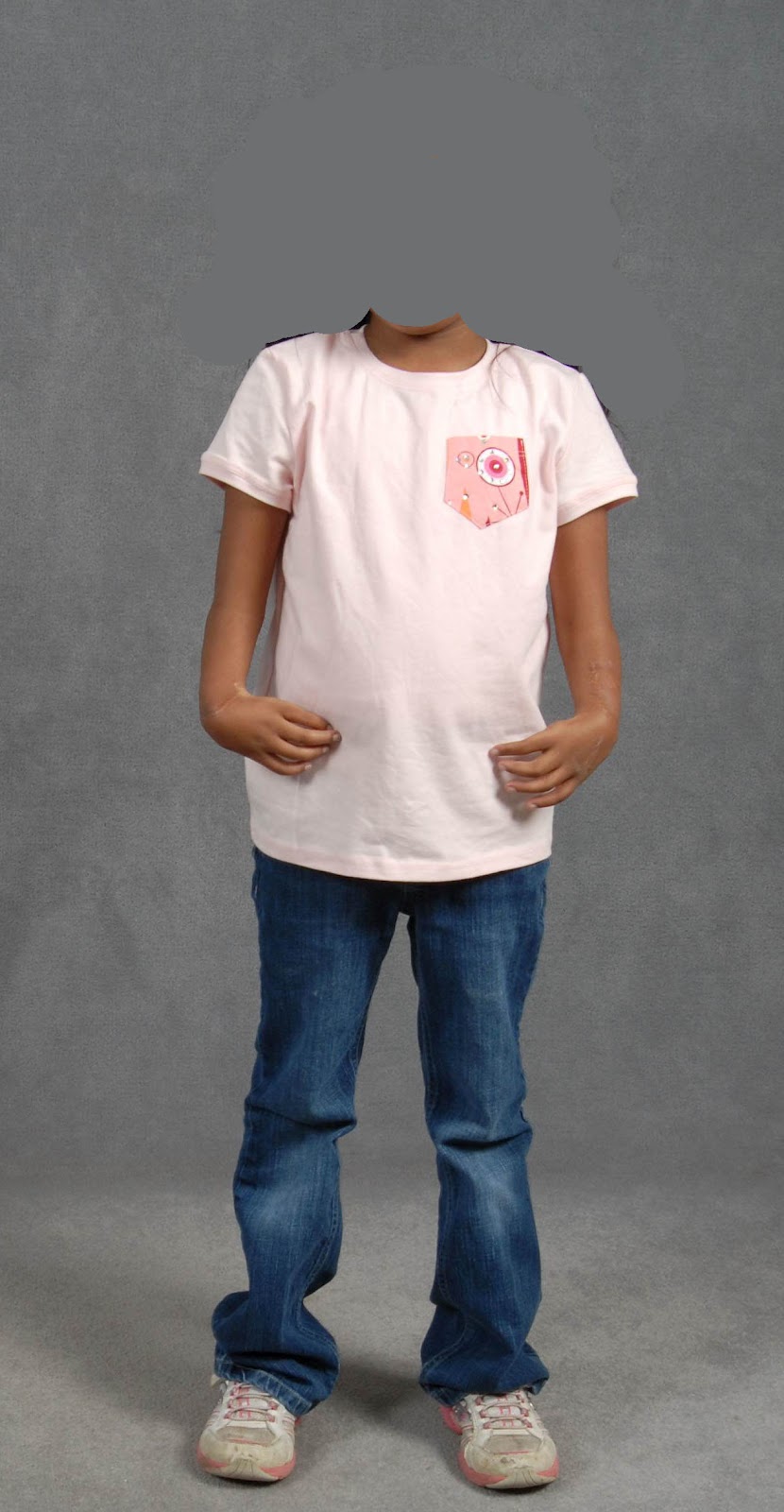 Recurrent Radial Longitudinal Deficiency | Congenital Hand and Arm ...