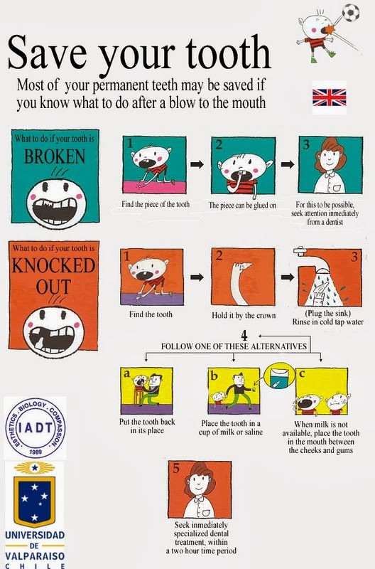 Ask.DentistMY 牙牙学医: Ask.Dentist: "Save" the knocked out tooth!