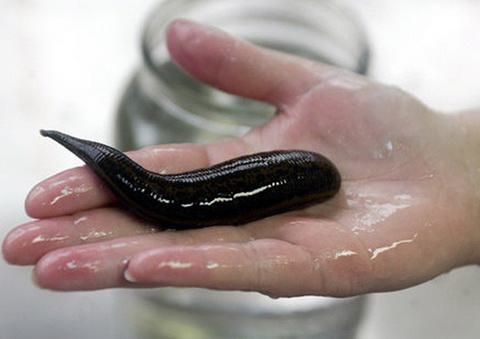 Lintah-Lintah Raksasa Untuk Terapi Kesehatan | Risalahati