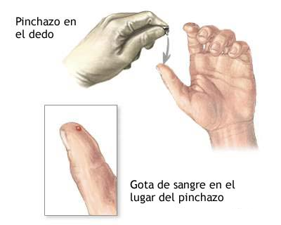 Conceptos y procedimientos de la salud: Punción capilar.