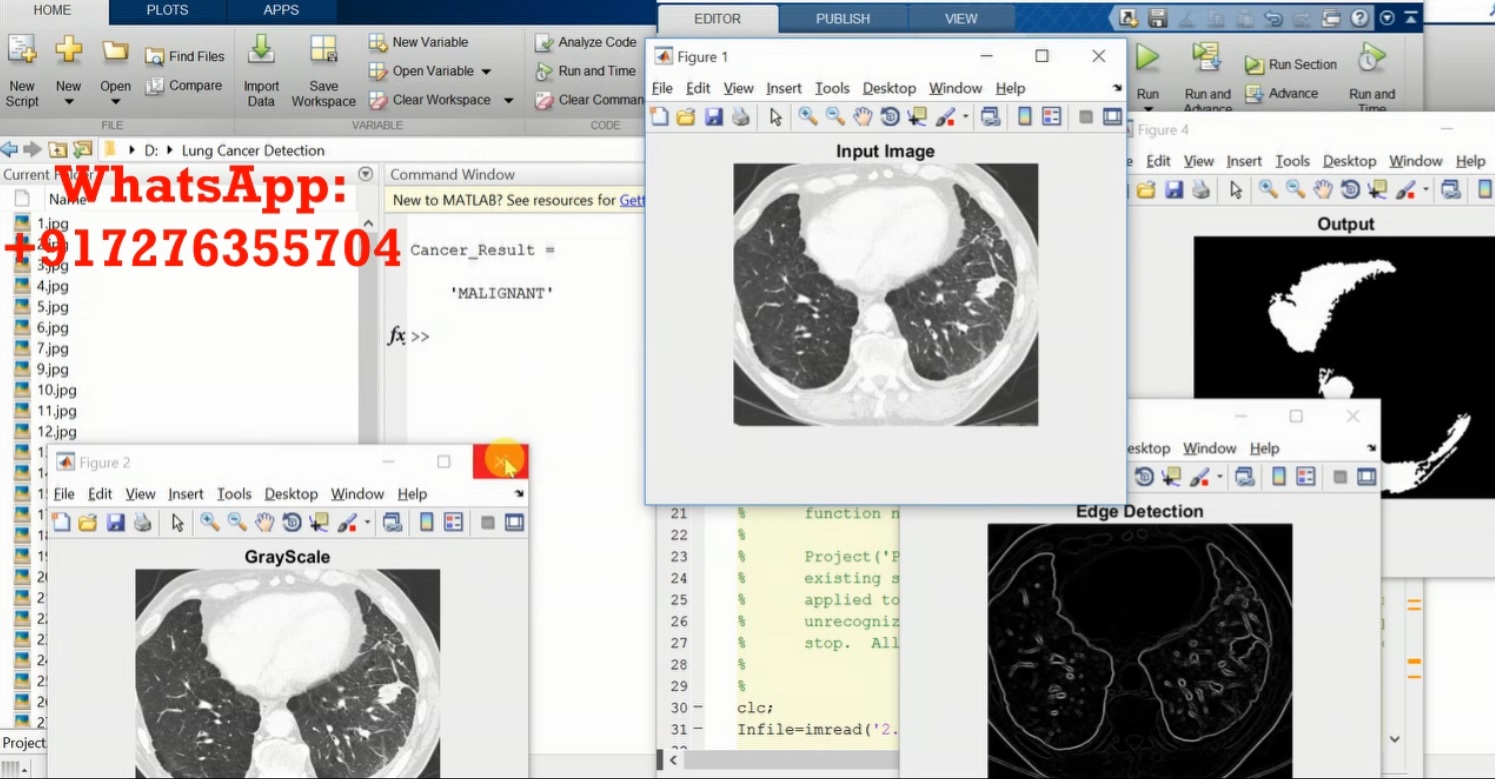 Lung Cancer Detection Using Matlab Project Source Code ~ Engineering Projects