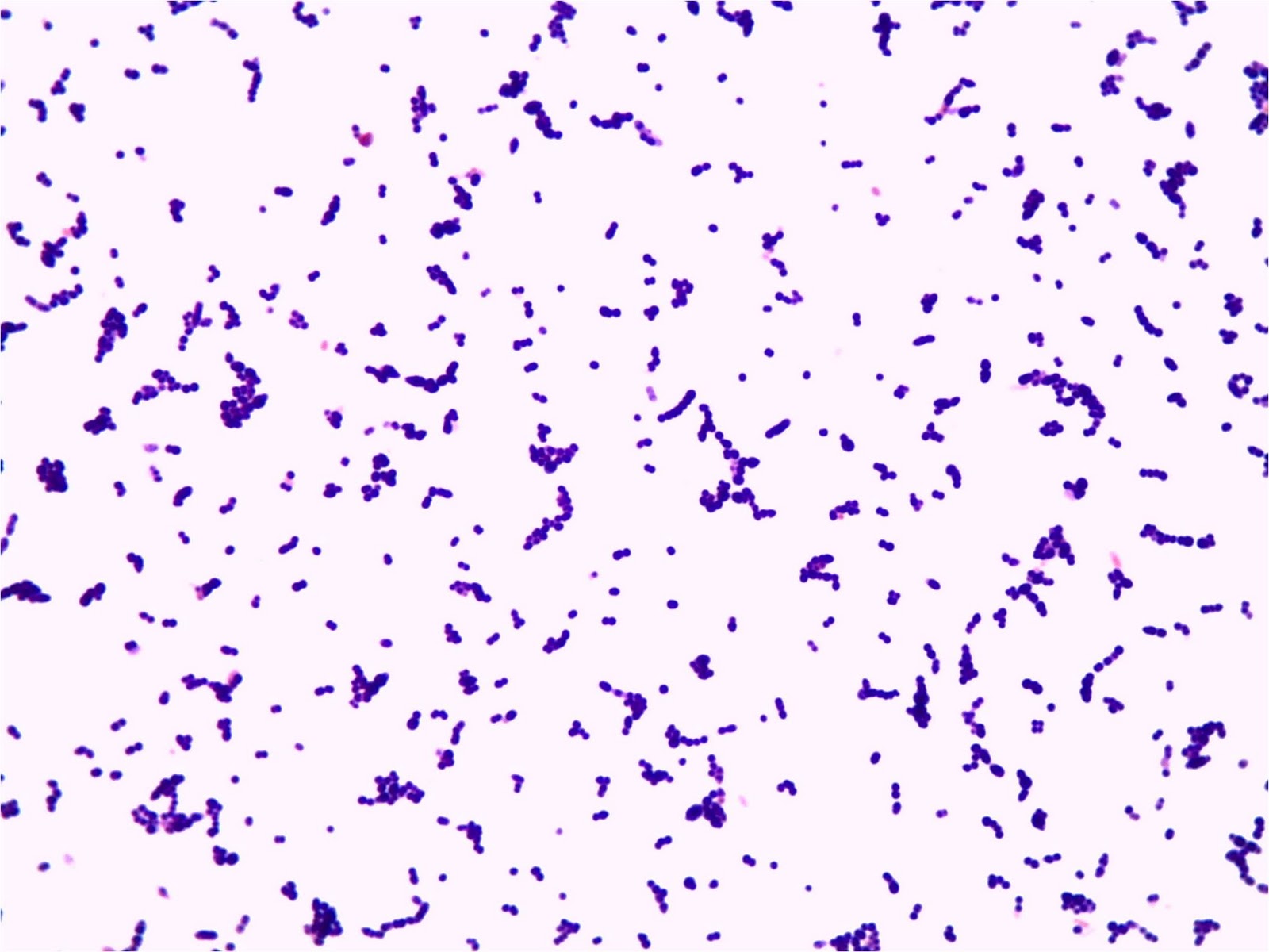 Streptococcus Gram Stain