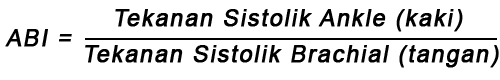 Pemeriksaan Ankle Brachial Index (ABI) Beserta Rumus & Contoh