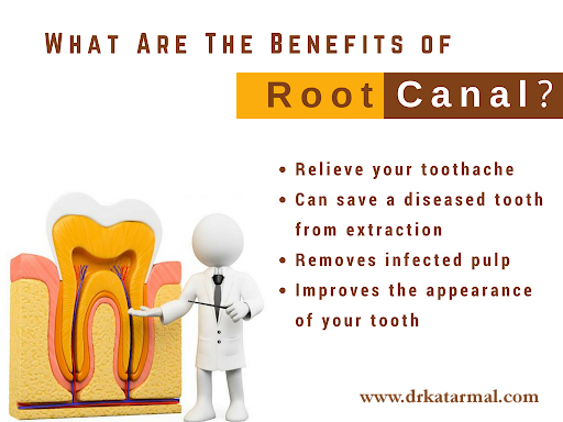 What Are The Benefits Of Root Canal Treatment Versus Extraction? ~ Dr ...