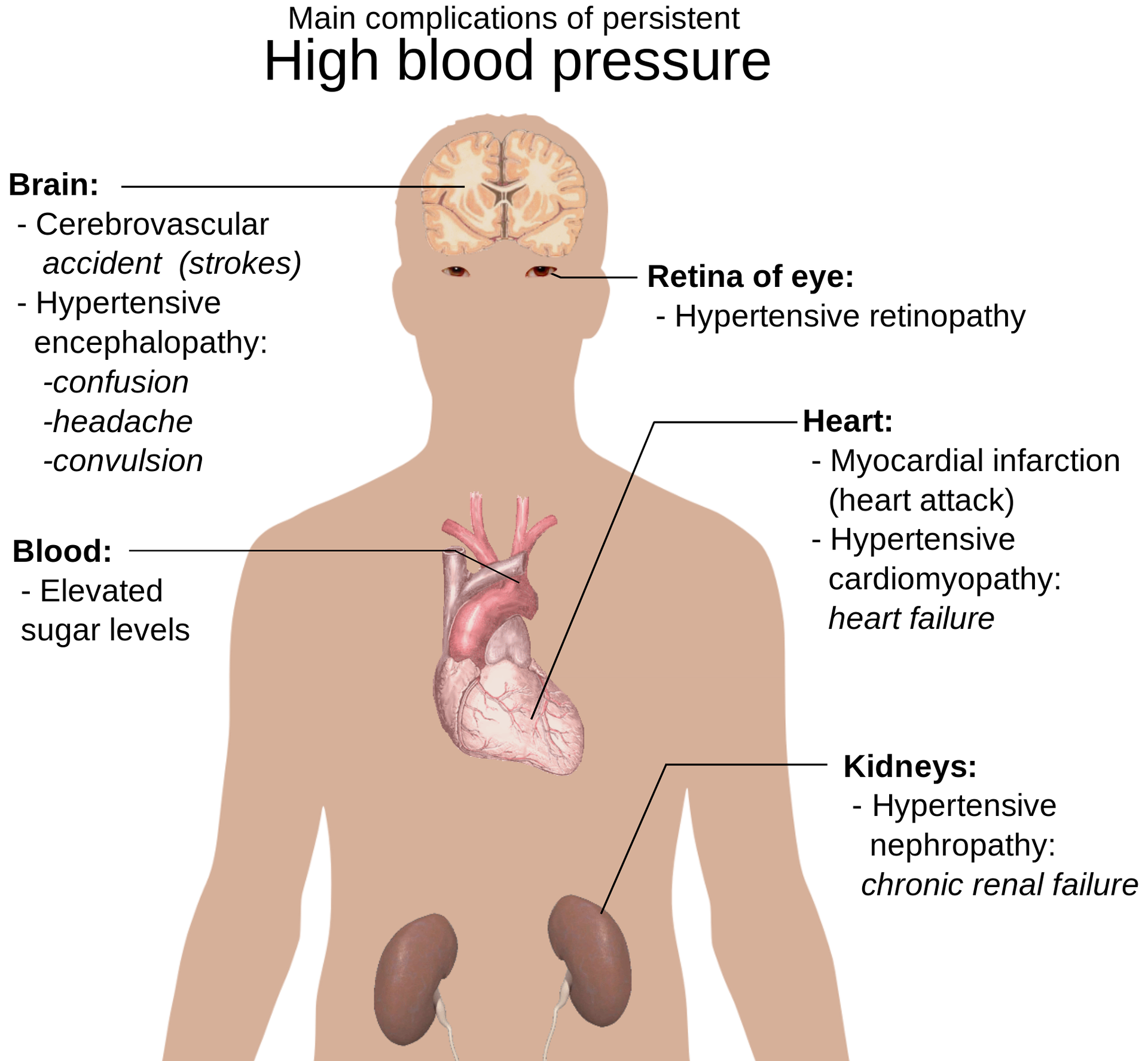 What Is The Meaning Of Hypertension Symptoms Causes Hypertension what-is-the-meaning-of-hypertension-symptoms-causes-hypertension