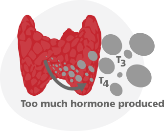UNDERSTANDING THYROID AND HYPERTHYROIDISM (Overactive Thyroid) - HEALTH ...