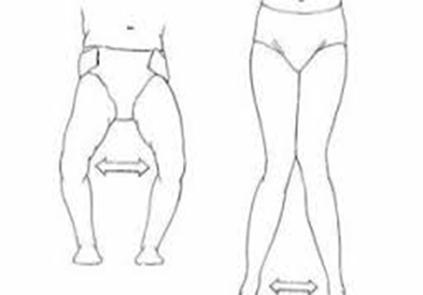 Development Of Legs Health And Information Ismail Mehmedov development-of-legs-health-and-information-ismail-mehmedov