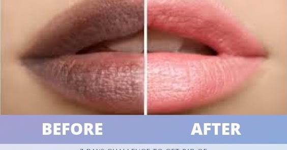 GET Light Color Lips – Turn Black Lips To Natural Pink - HEALTH LIFESTYLE
